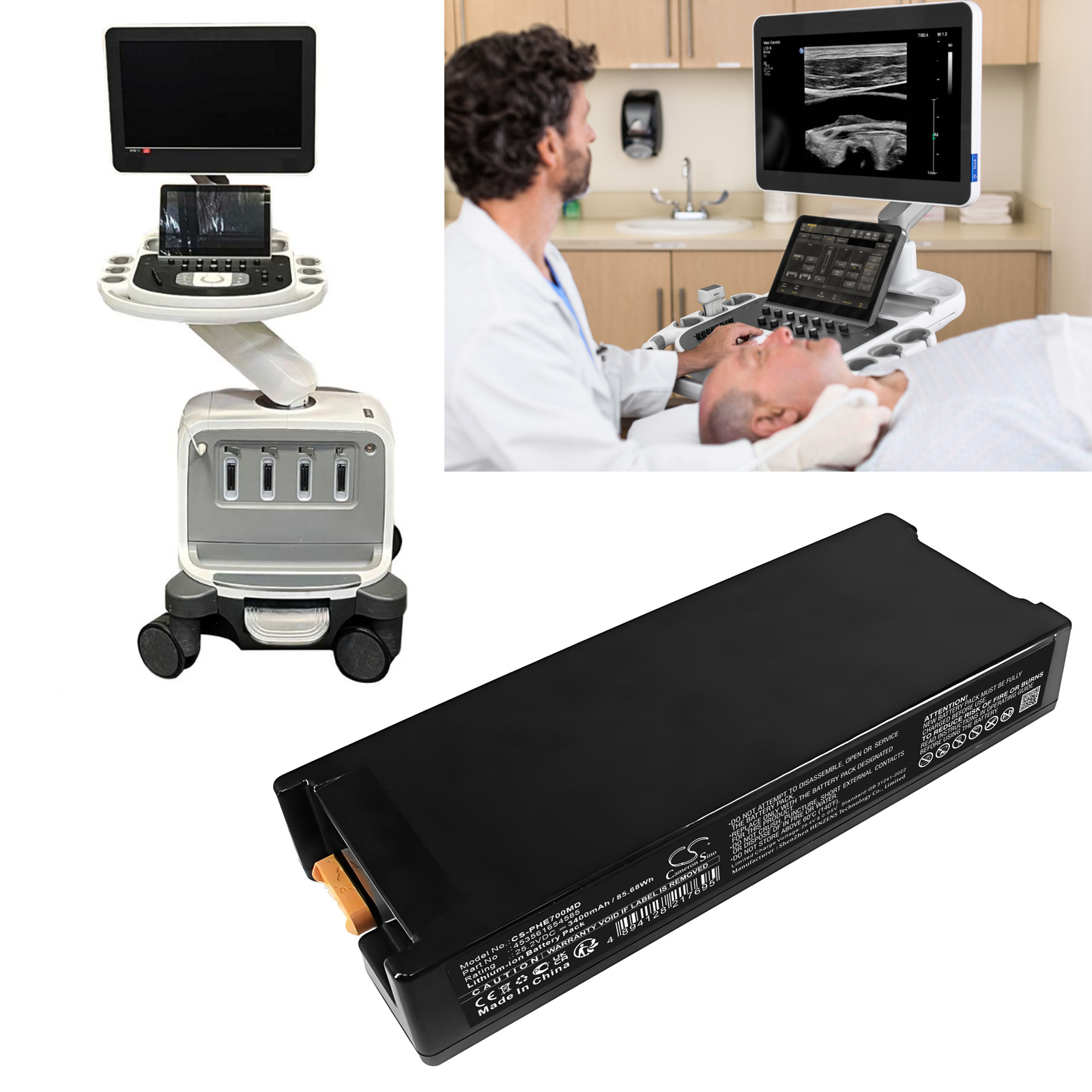 Ecógrafo Philips Epiq 7c / 453561654585 3400mAh Li-ion 25.2V (Cameron ...